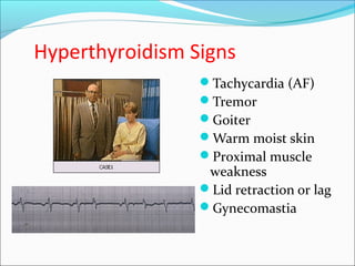 Thyroidhormone 140609084017-phpapp01 | PPT | Thyroid Disorders ...
