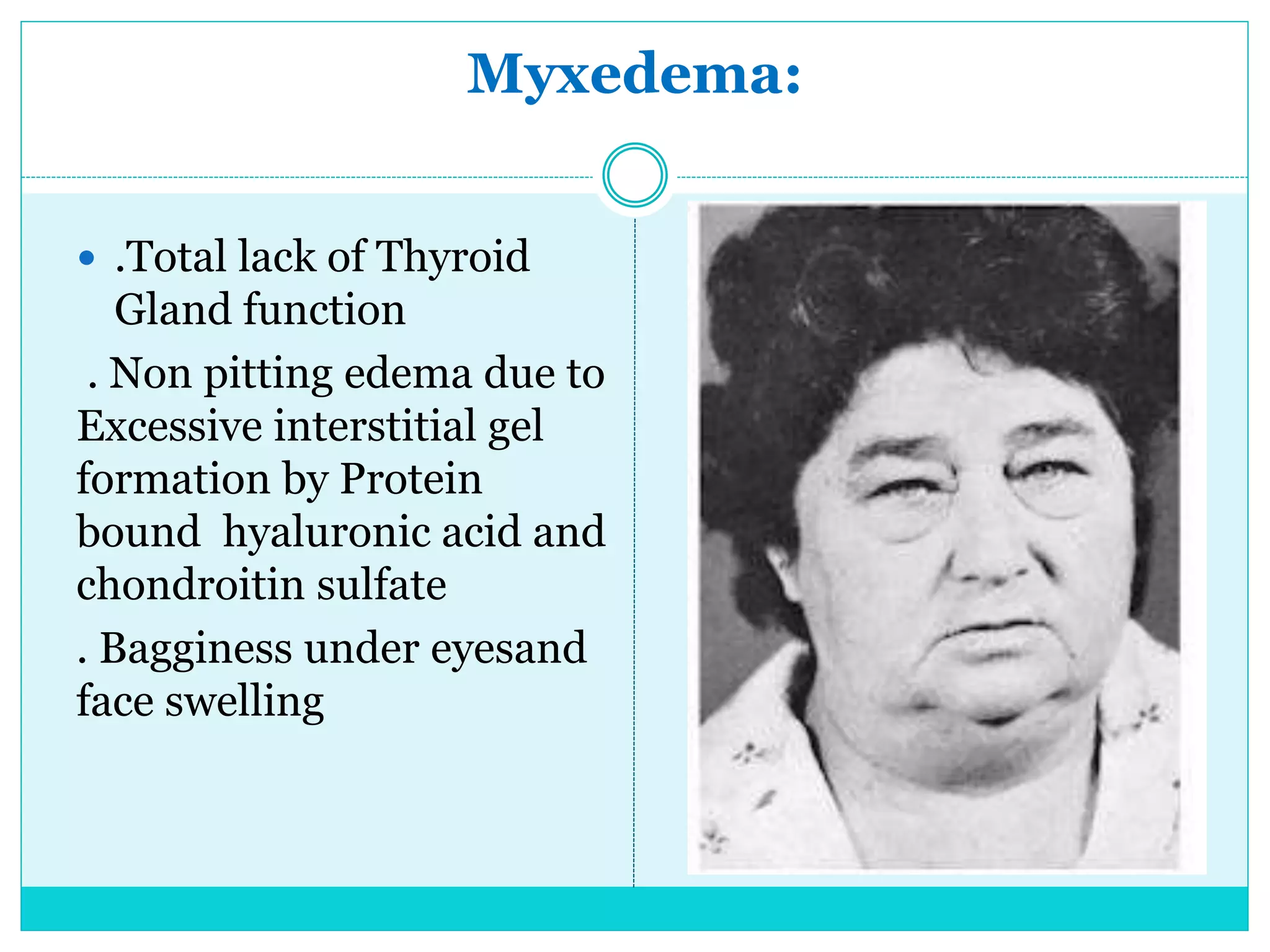 Thyroid hormone (The Guyton and Hall physiology) | PPTX