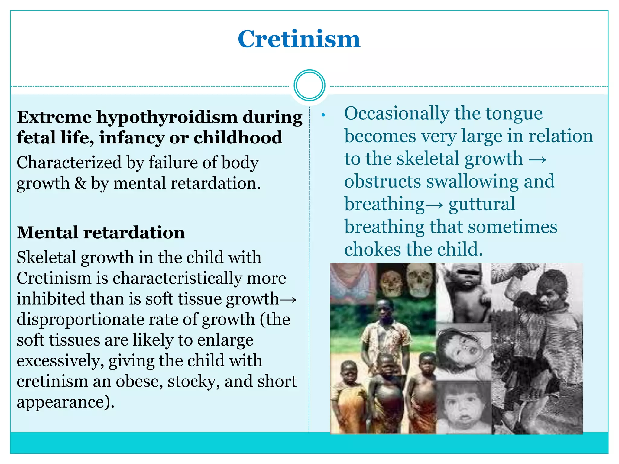 Thyroid hormone (The Guyton and Hall physiology) | PPTX