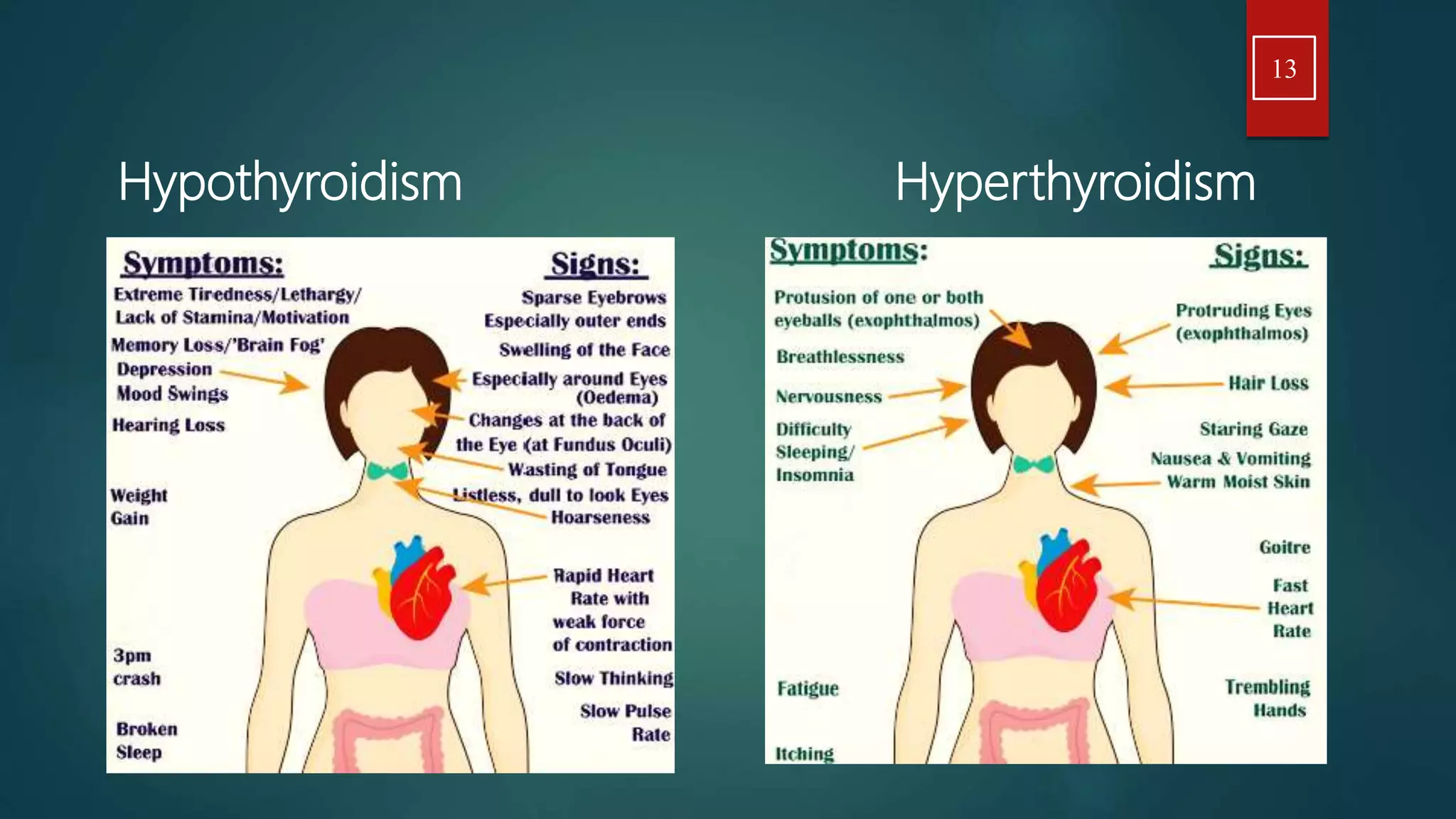 Thyroid hormone disorders | PPTX