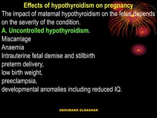 Hypothyroidism During pregnancy | PDF