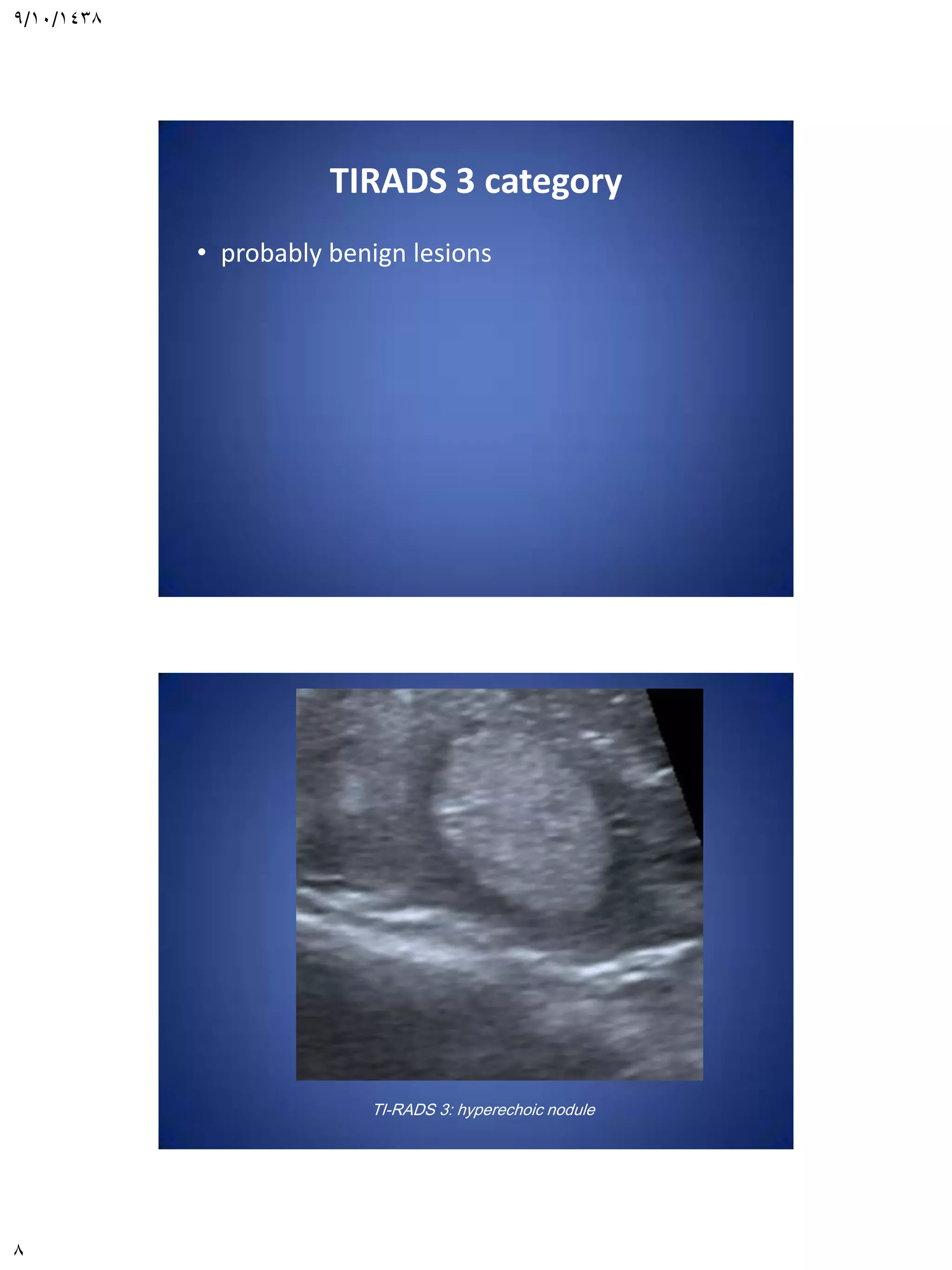 Thyroid image reporting and data system | PDF | Thyroid Disorders ...