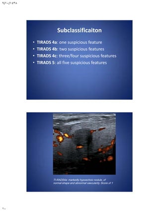 Thyroid image reporting and data system | PDF | Thyroid Disorders ...