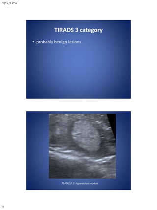 Thyroid image reporting and data system | PDF | Thyroid Disorders ...