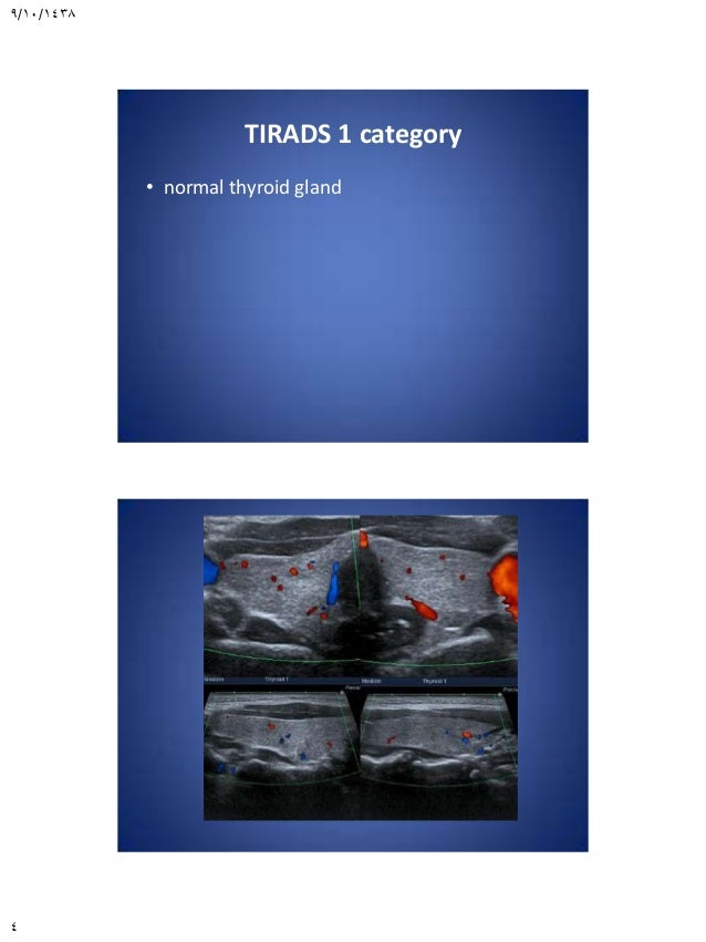 Thyroid image reporting and data system
