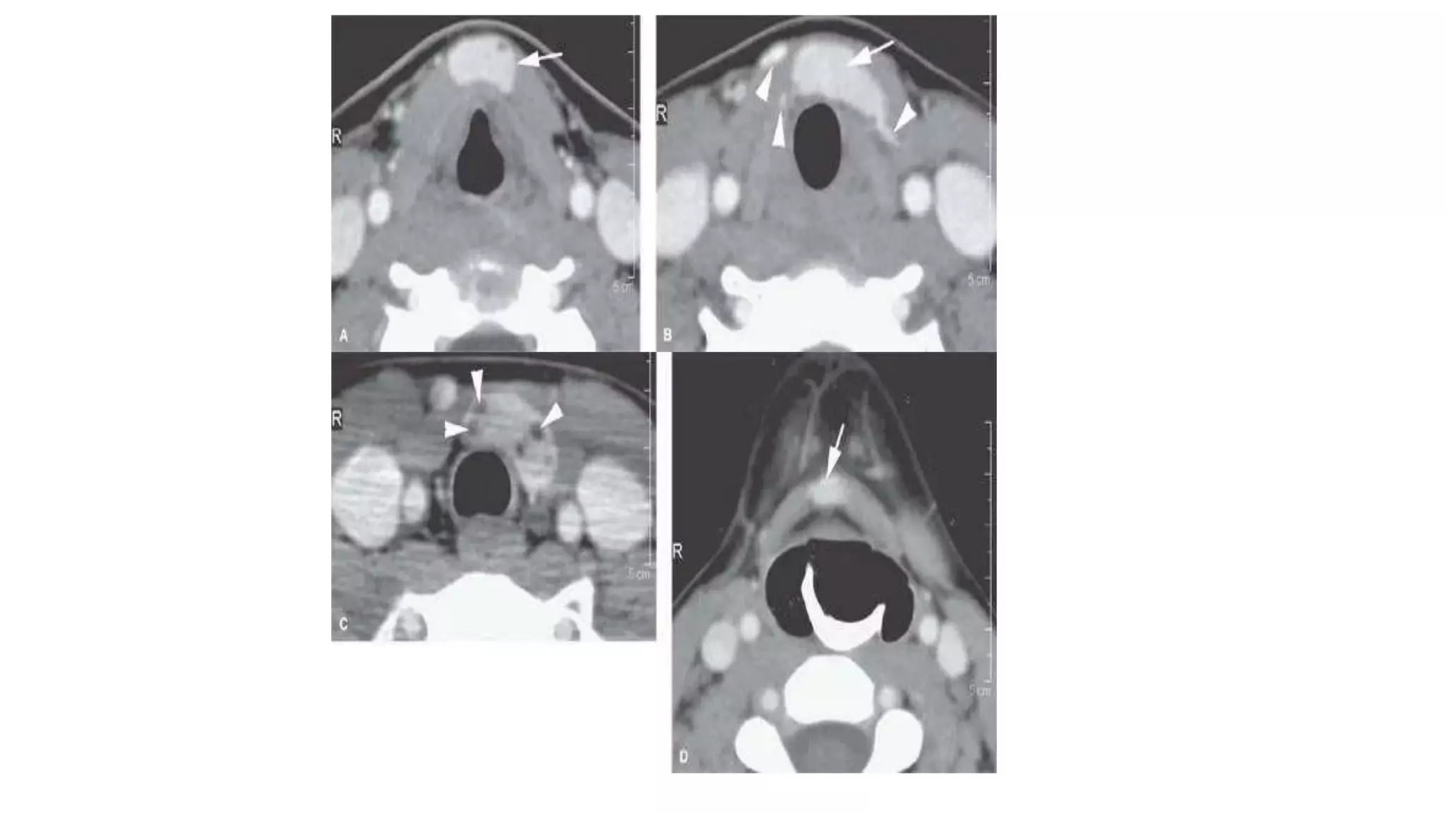 Thyroid imaging | PPTX