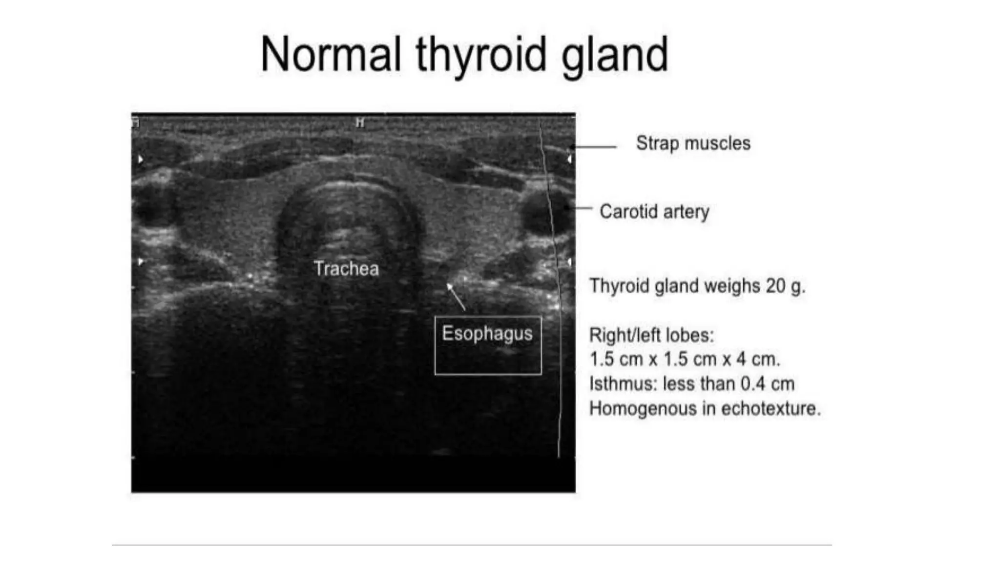 Thyroid imaging | PPTX