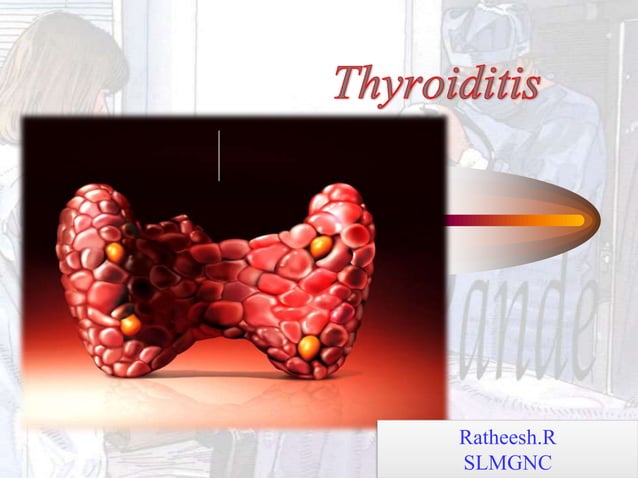Thyroiditis | PPTX