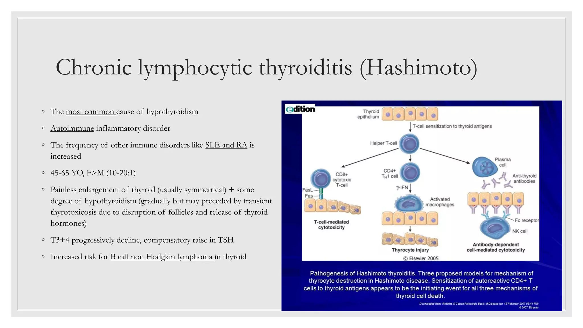 Thyroiditis | PPTX