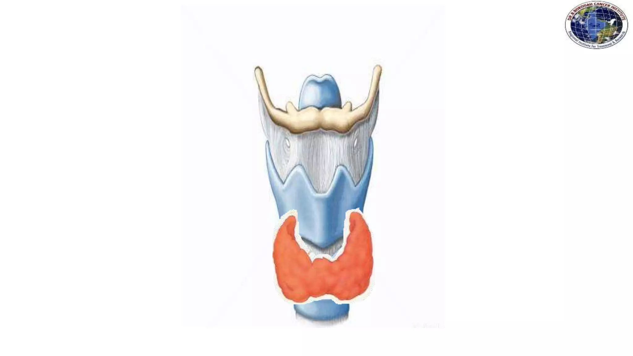 Thyroid Malignancies Pptx