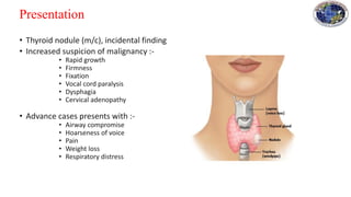 Thyroid malignancies | PPTX