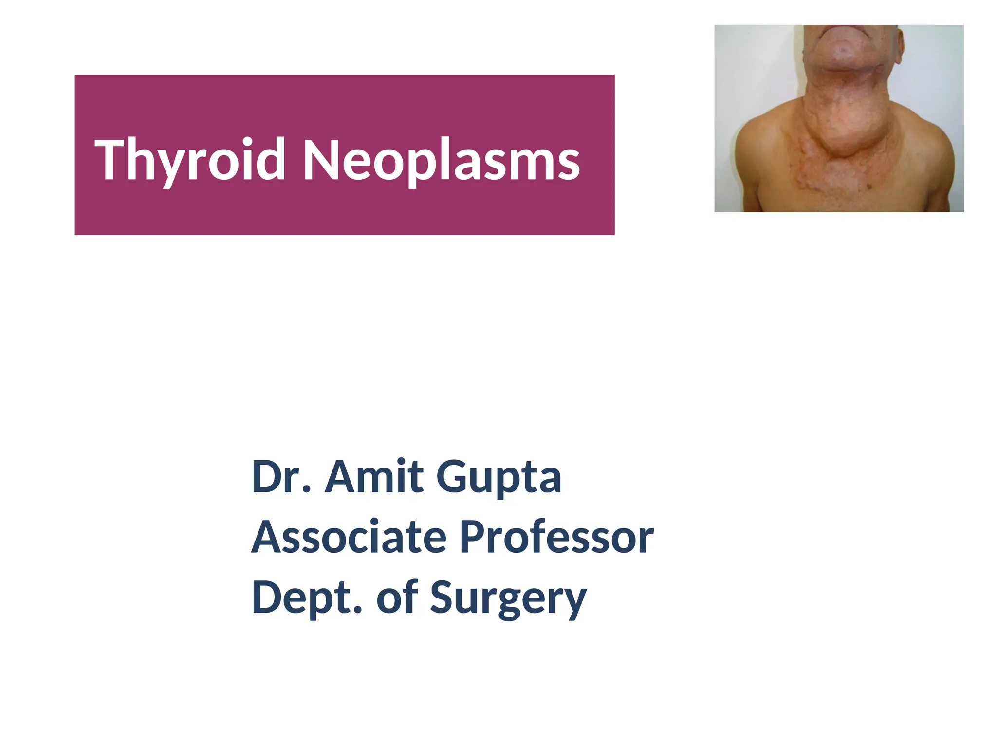 Classification of Thyroid Tumors: A Standardized Diagnostic Approach | PPT