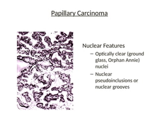 Classification of Thyroid Tumors: A Standardized Diagnostic Approach | PPT