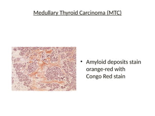 Classification of Thyroid Tumors: A Standardized Diagnostic Approach | PPT