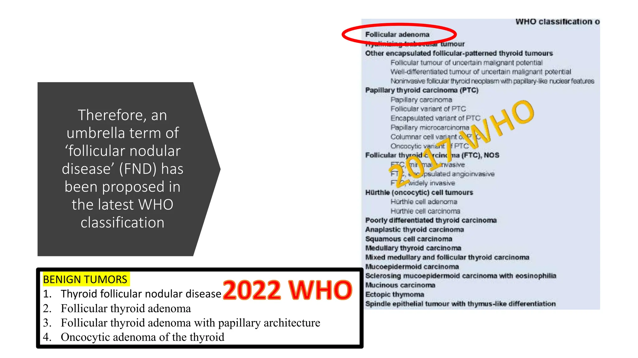 Thyroid Neoplasms an update based on latest WHO | PPTX
