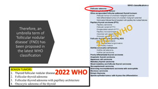 Thyroid Neoplasms an update based on latest WHO | PPTX