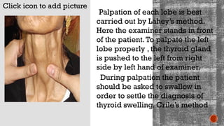 Examination of thyroid gland... general surgery | PPTX