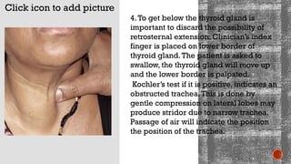 Examination of thyroid gland... general surgery | PPTX