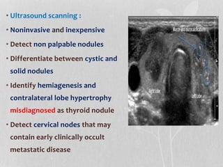 Approach to Thyroid nodule | PPTX