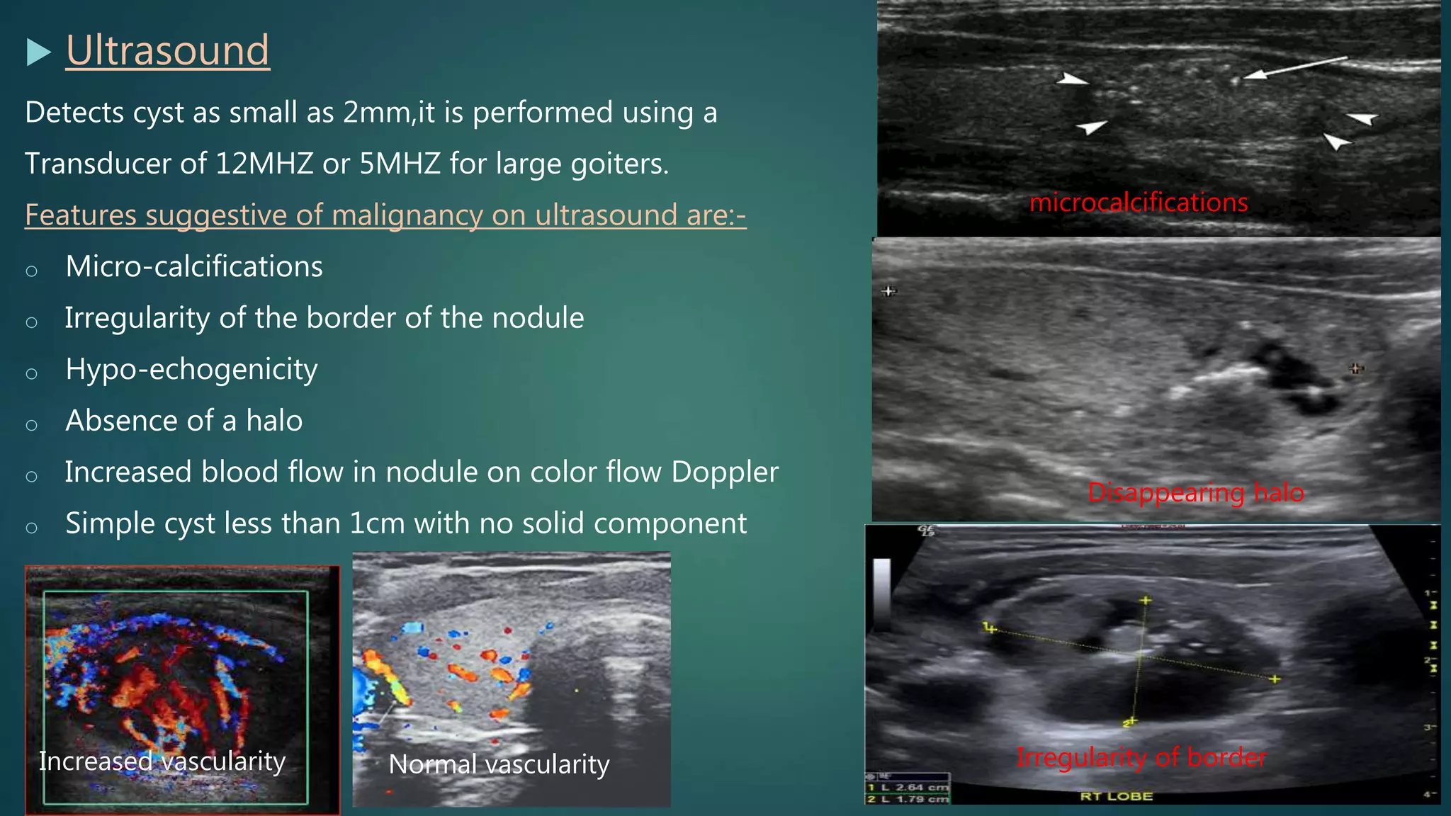 Solitary Cold Nodule Of Thyroid Ppt