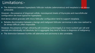 solitary cold nodule of thyroid | PPT
