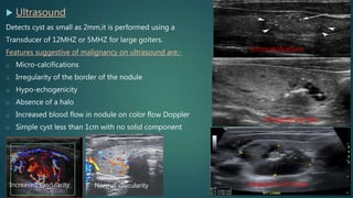 solitary cold nodule of thyroid | PPTX