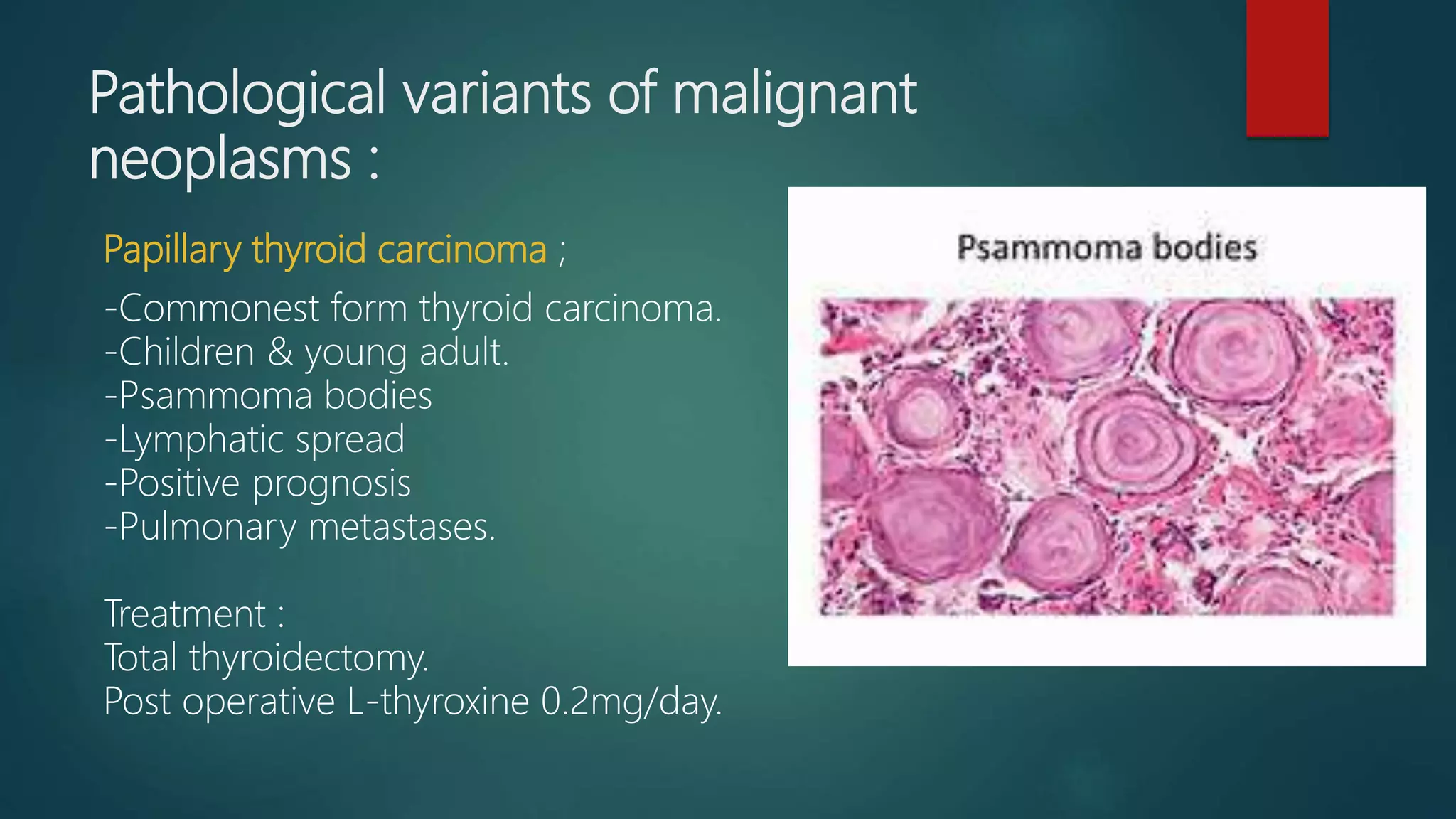 Thyroid nodule & neoplasms | PPTX