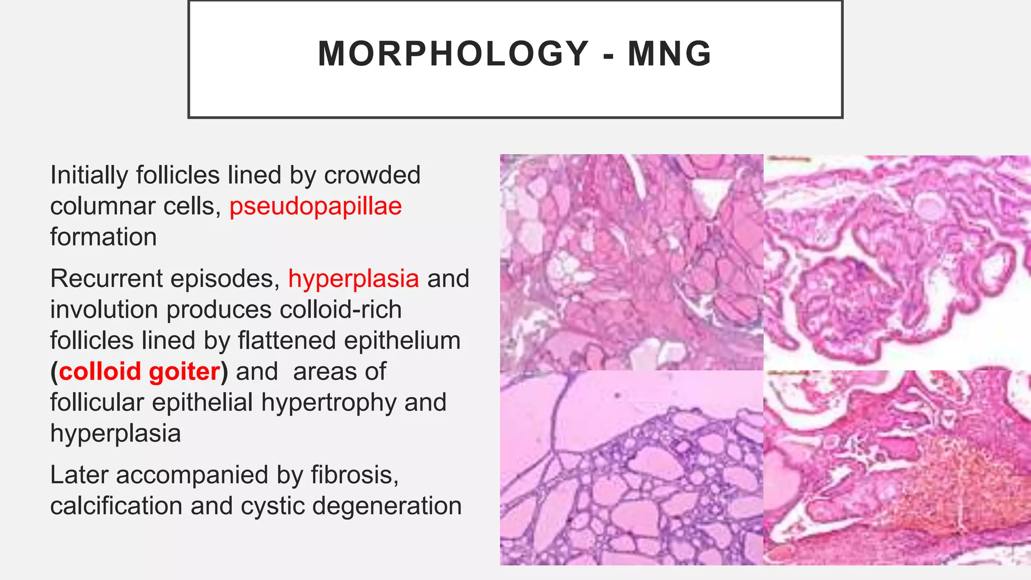 Thyroid non neoplastic lesions | PPTX