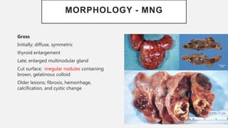 Thyroid non neoplastic lesions | PPTX