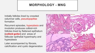 Thyroid non neoplastic lesions | PPTX