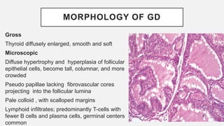 Thyroid non neoplastic lesions | PPTX
