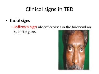 Thyroid ophthalmopathy | PPTX