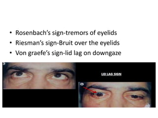 Thyroid ophthalmopathy | PPTX
