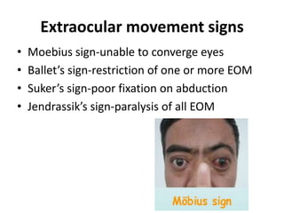 Thyroid ophthalmopathy | PPTX