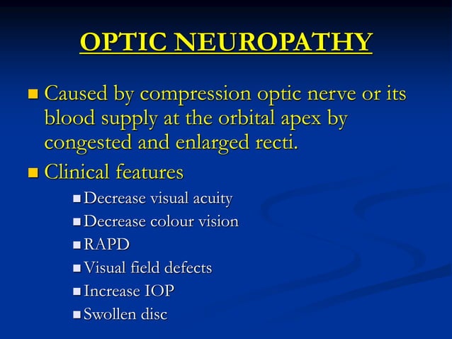 THYROID OPHTHALMOPATHY.ppt