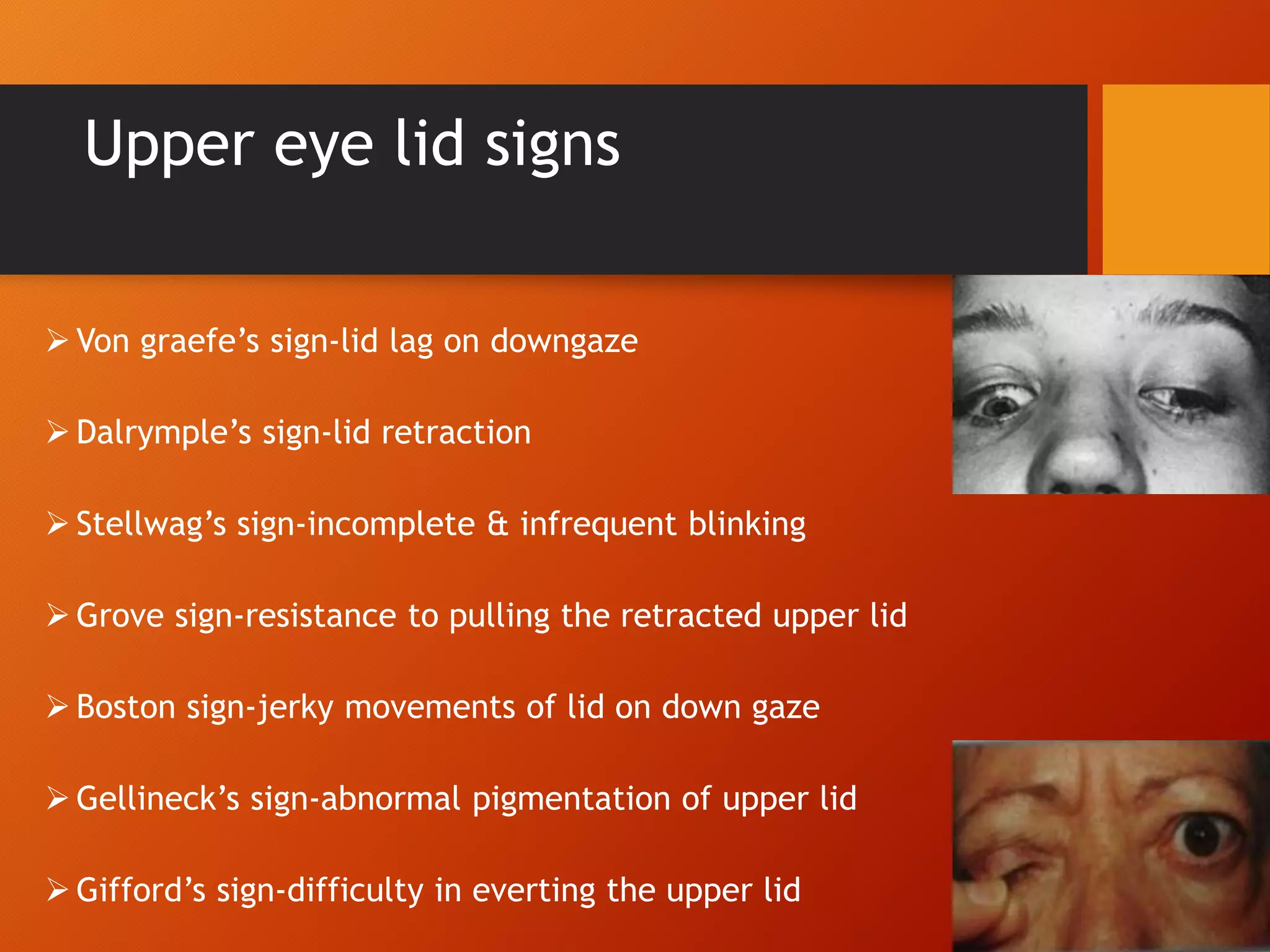 Thyroid ophthalmopathy | PPTX