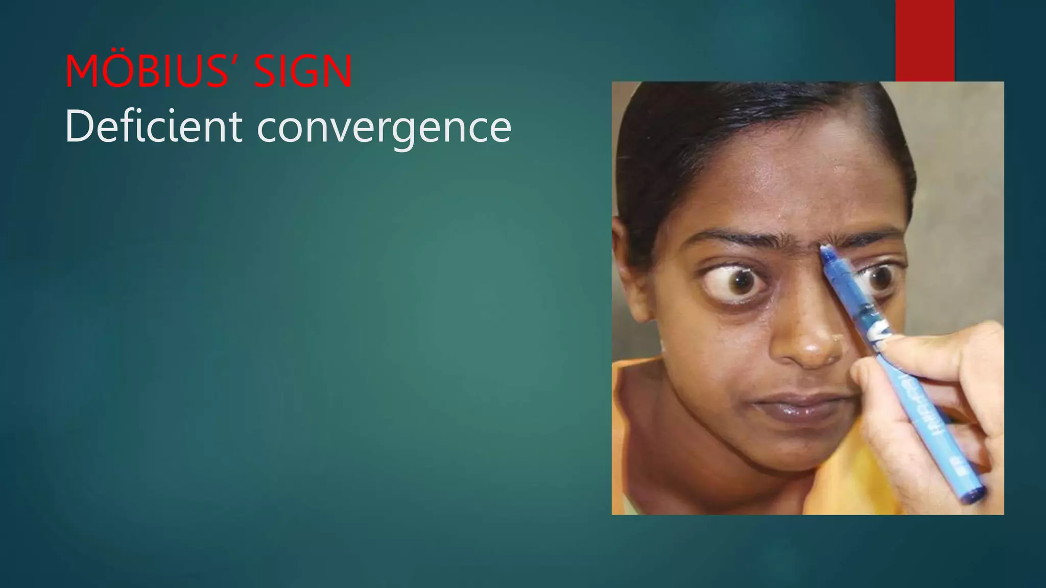 Thyroid Palpation | PPTX