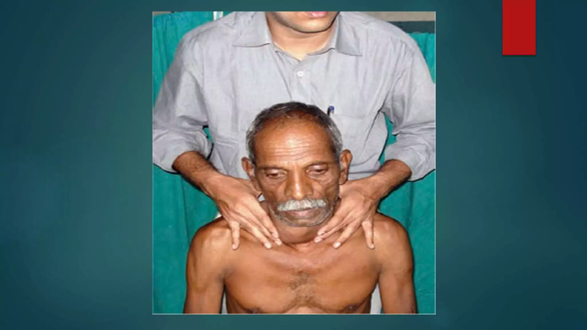 Thyroid Palpation | PPTX