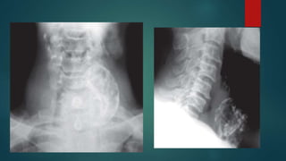 Thyroid Palpation | PPTX