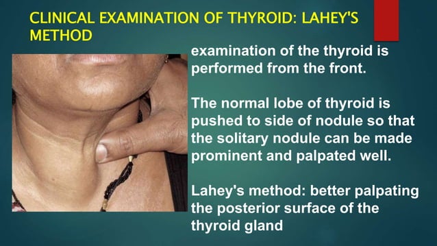Thyroid Palpation | PPTX