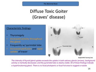Thyroid pathophysiology scintigraphy[1] | PPTX