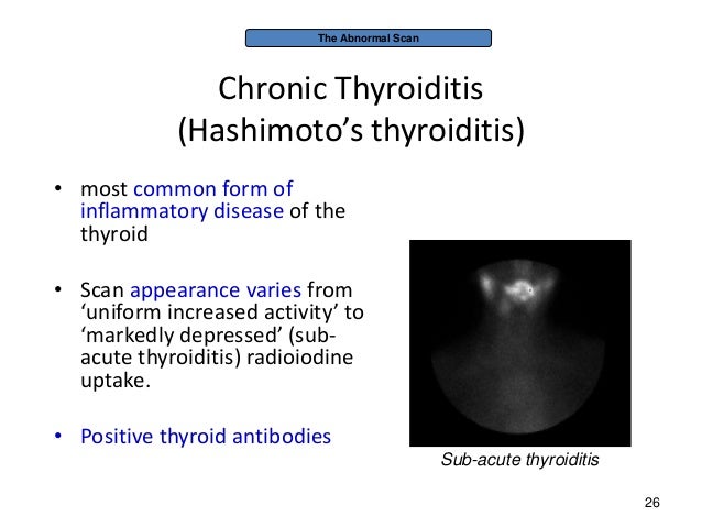 Thyroid pathophysiology scintigraphy[1]