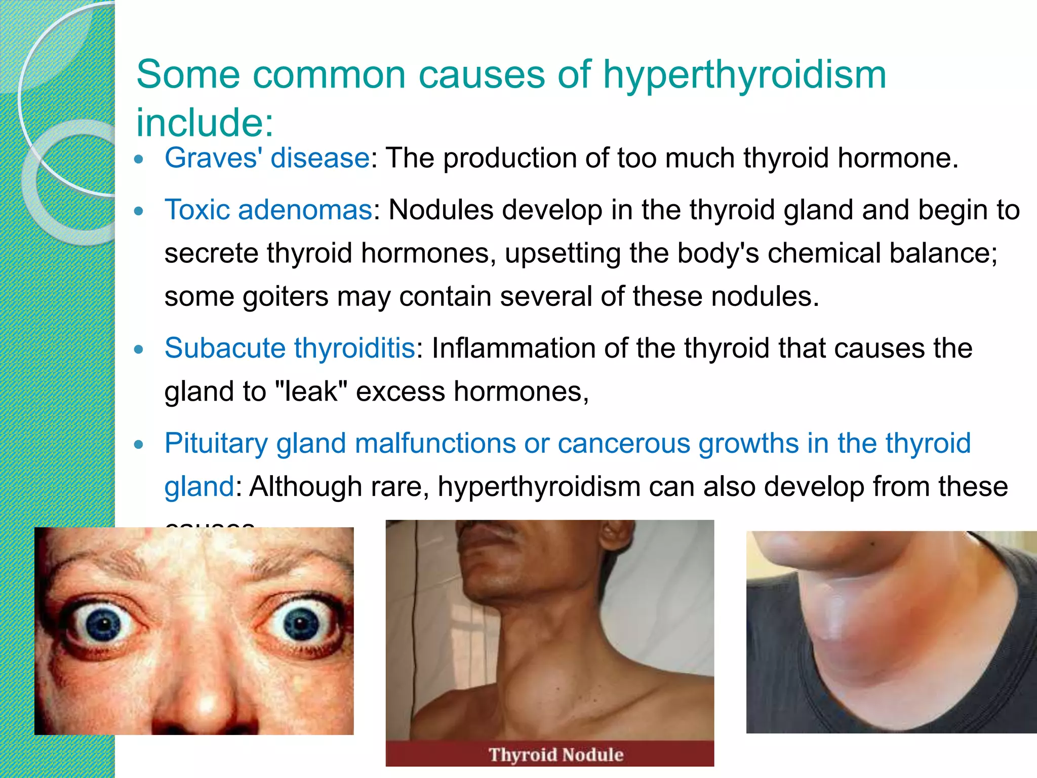 Thyroid ppt | PPTX