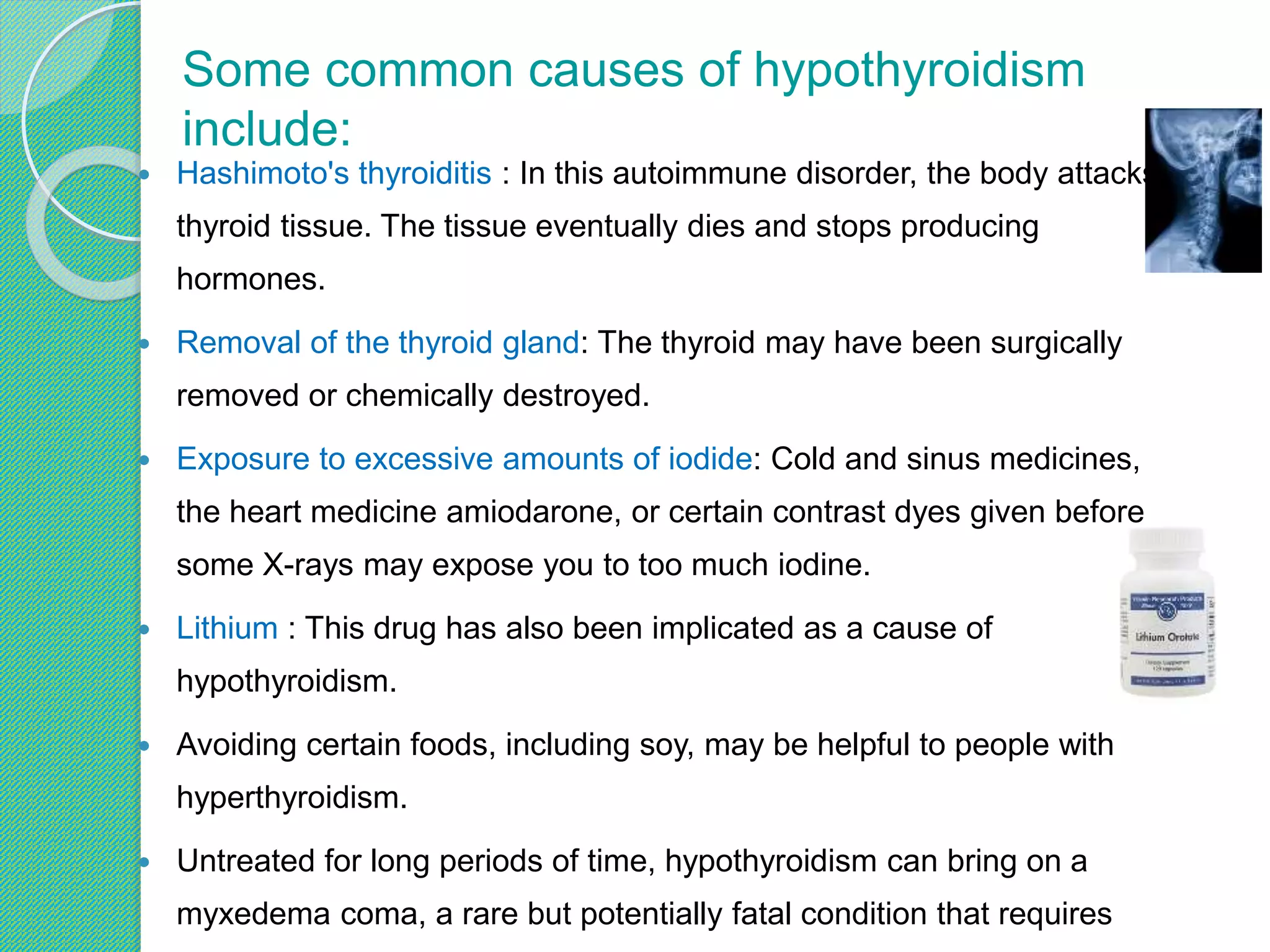 Thyroid ppt | PPTX