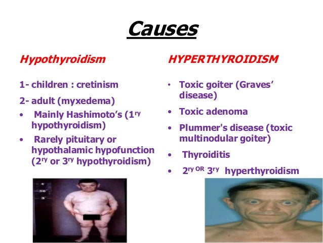 Thyroid presentation