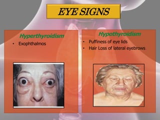 thyroid presentation.pptx | Thyroid Disorders | Endocrine and Metabolic ...