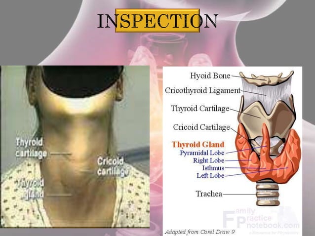 thyroid presentation.pptx