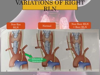 thyroid presentation.pptx | Thyroid Disorders | Endocrine and Metabolic ...