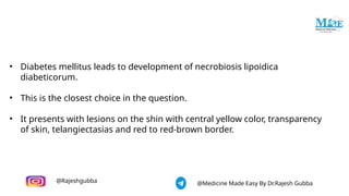 Thyroid Questions & Answers and edap.pptx