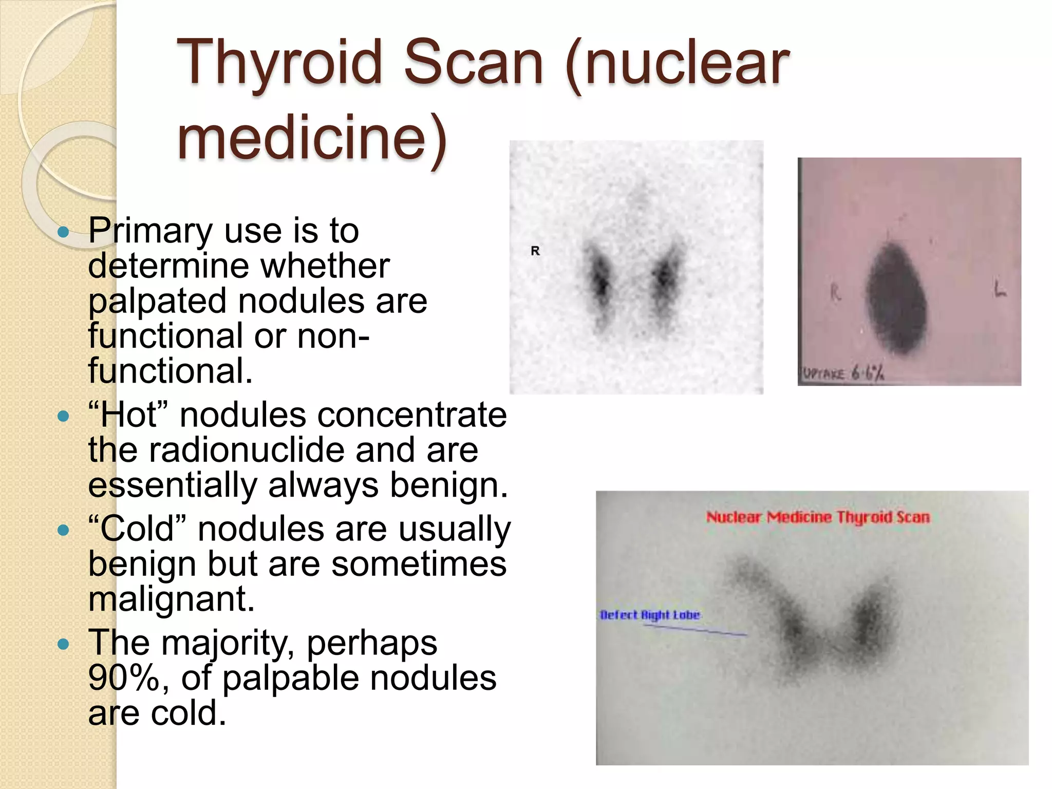 Thyroid Gland and Disease of Thyroid Gland | PPTX